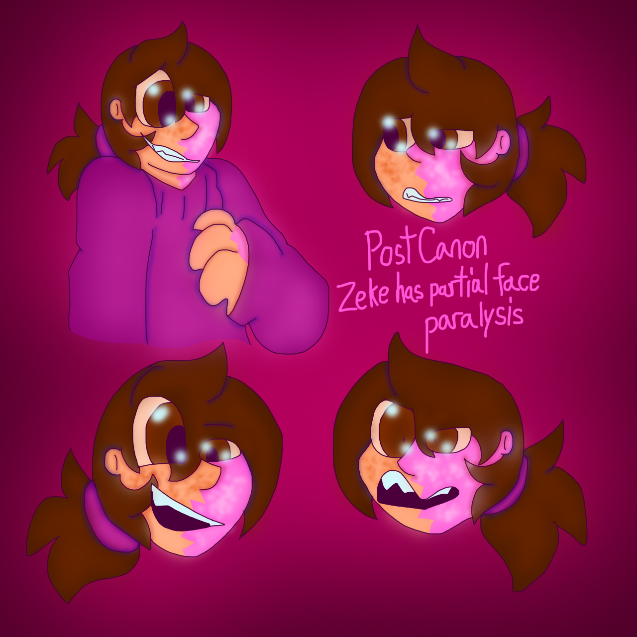 Zeke with face paralysis by @kittenpinkamations – Sheezy.Art